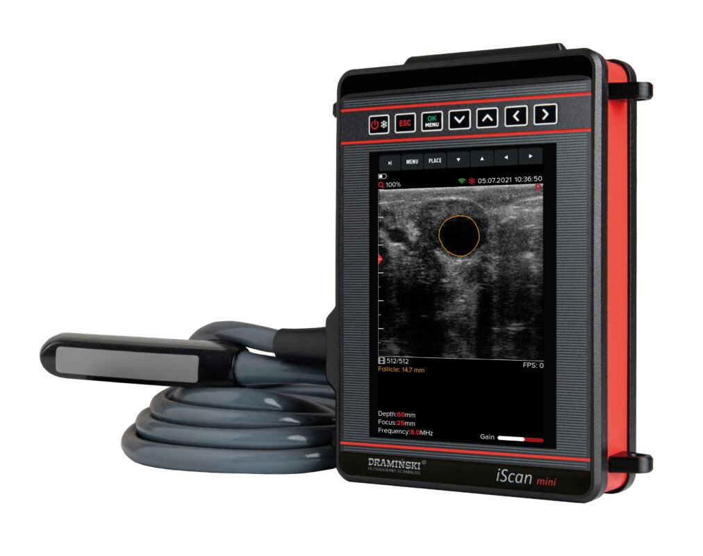 Ultrasound iscan Mini - sonotech