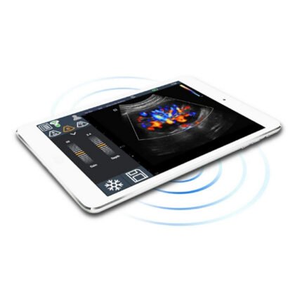 Youkey D8C and B Wifi Ultrasound probes - sonotech