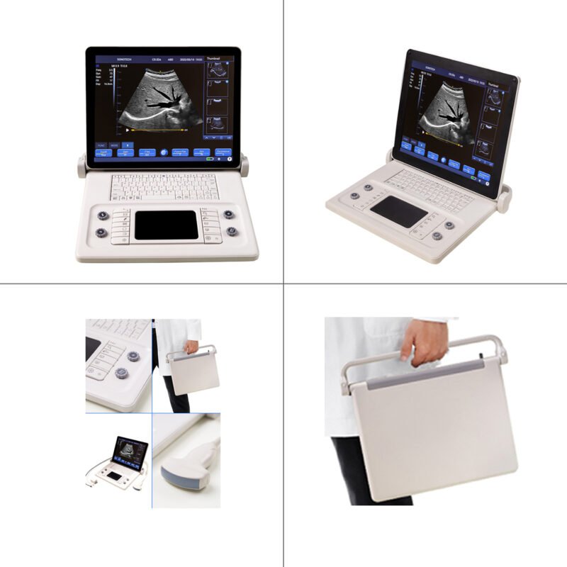 D8 Youkey Ultrasound machine - +92 335 4000190